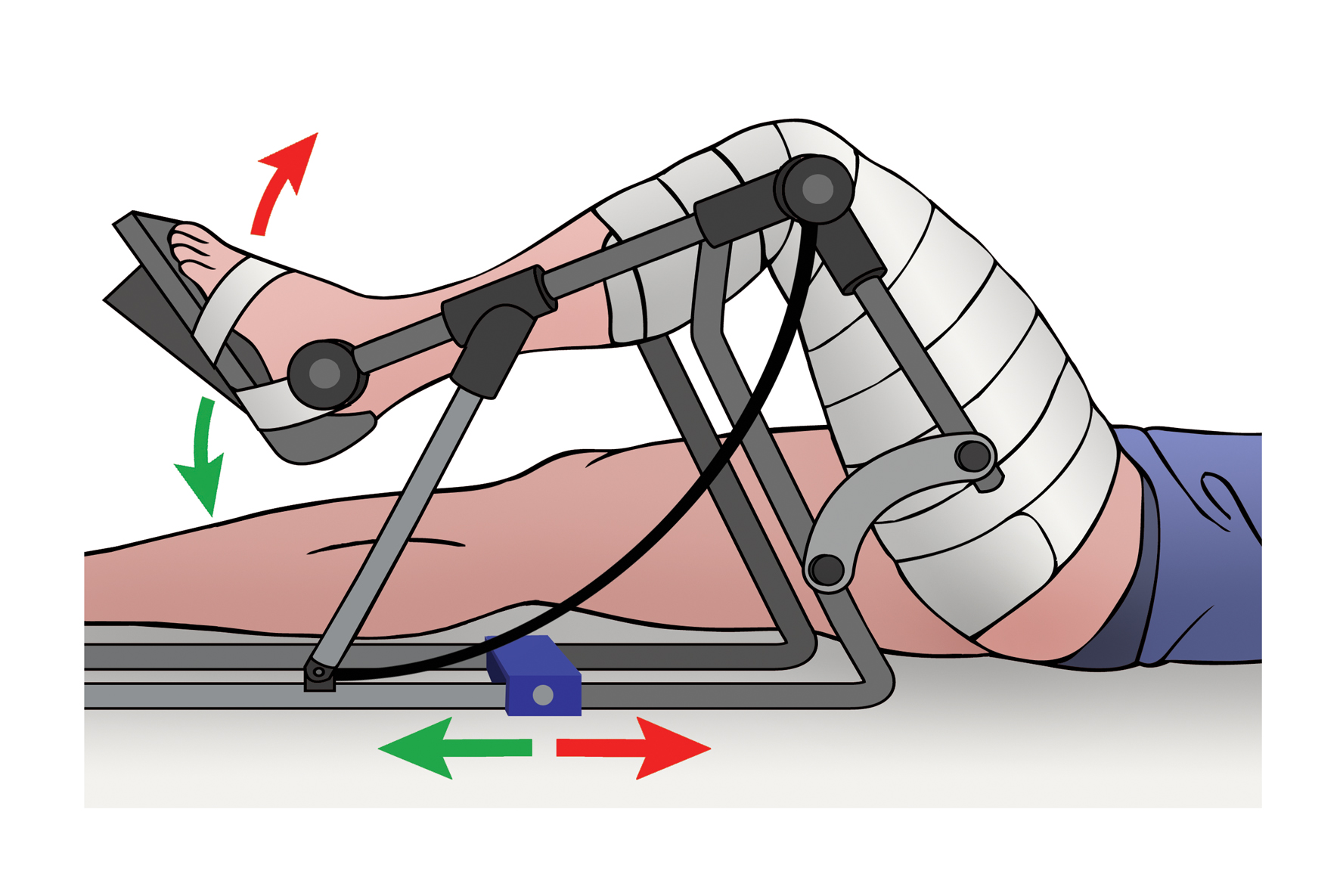 Sports Injury Bulletin - Anatomy - Knee microfracture- Part II: post ...