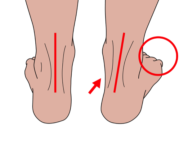 Sports Injury Bulletin - Anatomy - Tibialis posterior tendon: a key ...
