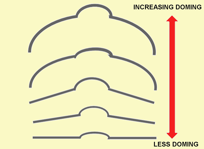 Sports Injury Bulletin - Anatomy - Mind the gap: Diastasis recti in ...