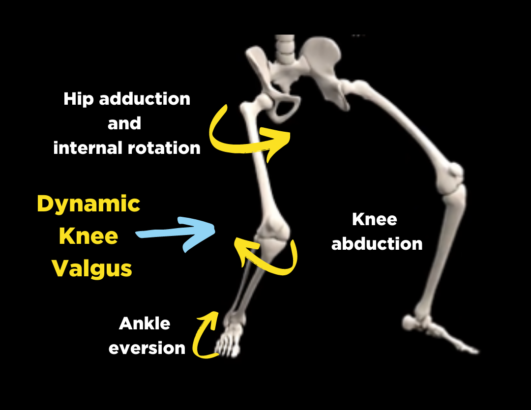Sports Injury Bulletin - Anatomy - Demands of Sport: Part VI – mapping ...