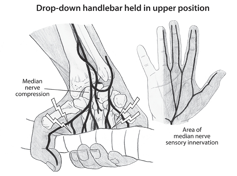 Sports Performance Bulletin - Overuse injuries - Cycling injury ...