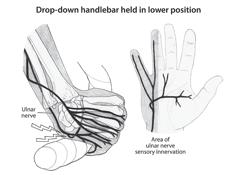 Sports Performance Bulletin - Overuse injuries - Cycling injury ...