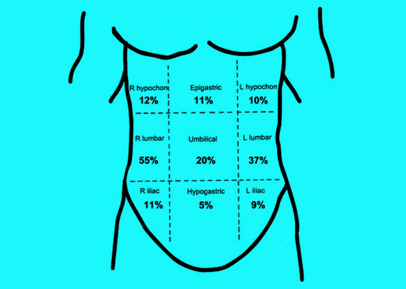 Sports Performance Bulletin - Endurance injuries and health - Stitch ...