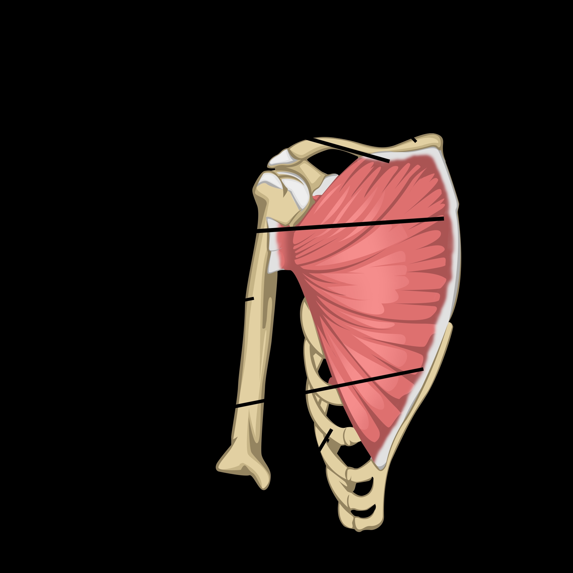 Sports Injury Bulletin - Diagnose & Treat - Uncommon injuries ...