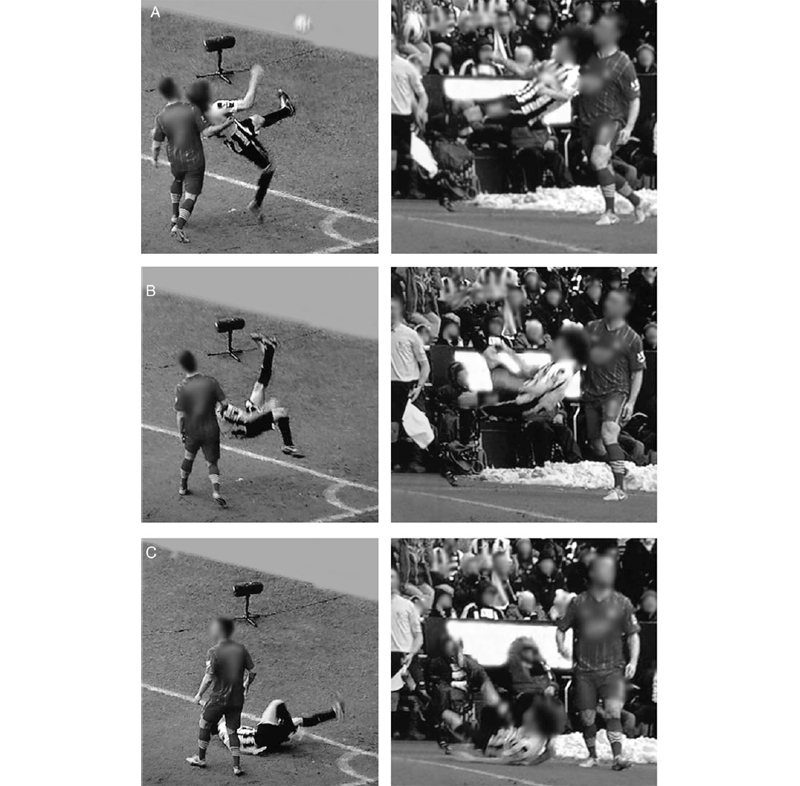 Sports Injury Bulletin - Diagnose & Treat - Lumbar transverse process ...