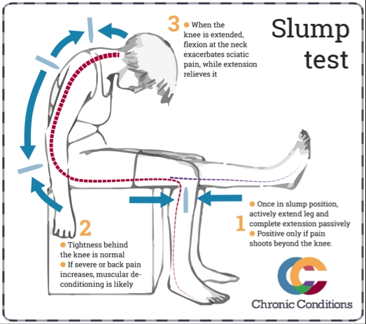 Sports Injury Bulletin - Diagnose & Treat - Neuro-dynamics: mobilizing ...