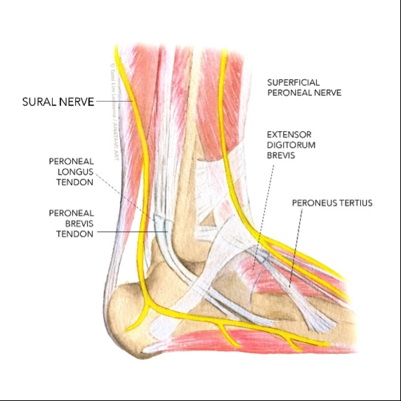 Sports Injury Bulletin - Diagnose & Treat - Uncommon injuries: sural ...