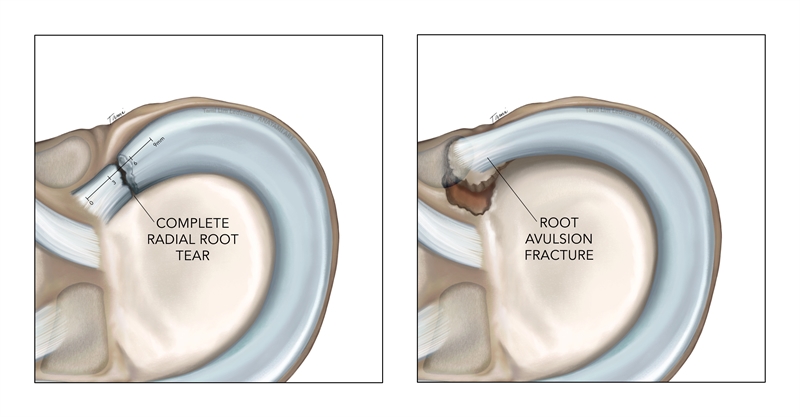 Sports Injury Bulletin - Diagnose & Treat - Uncommon injuries: getting ...