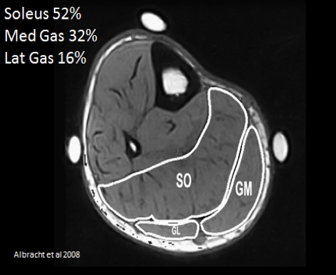 Sports Injury Bulletin - Diagnose & Treat - Patellofemoral pain: soleus ...